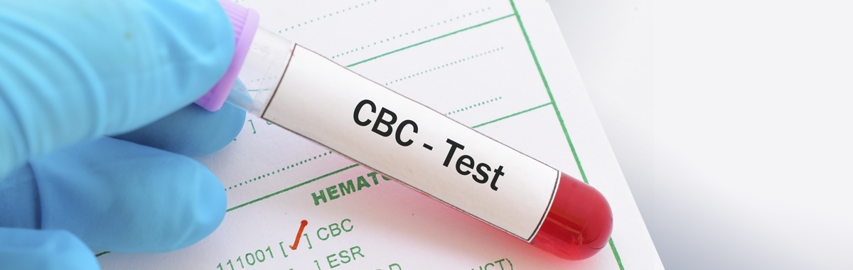 What Are Normal White And Red Blood Cell Counts Mercy Health Blog What Are Normal White And Red Blood Cell Counts Mercy Health Blog