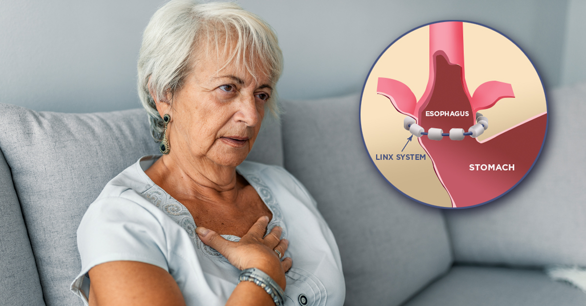 GERD and LINX Device Surgery | Mercy Health Blog